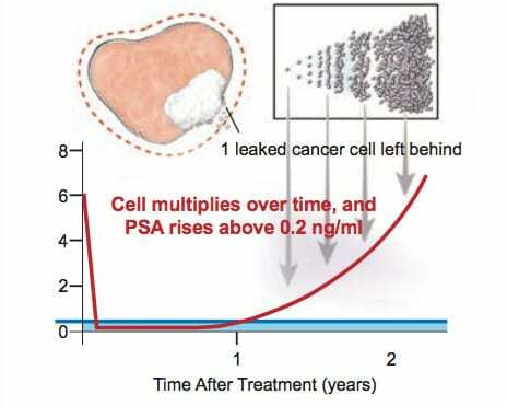 PSA Test to Determine Cure | Georgia Radiation Therapy